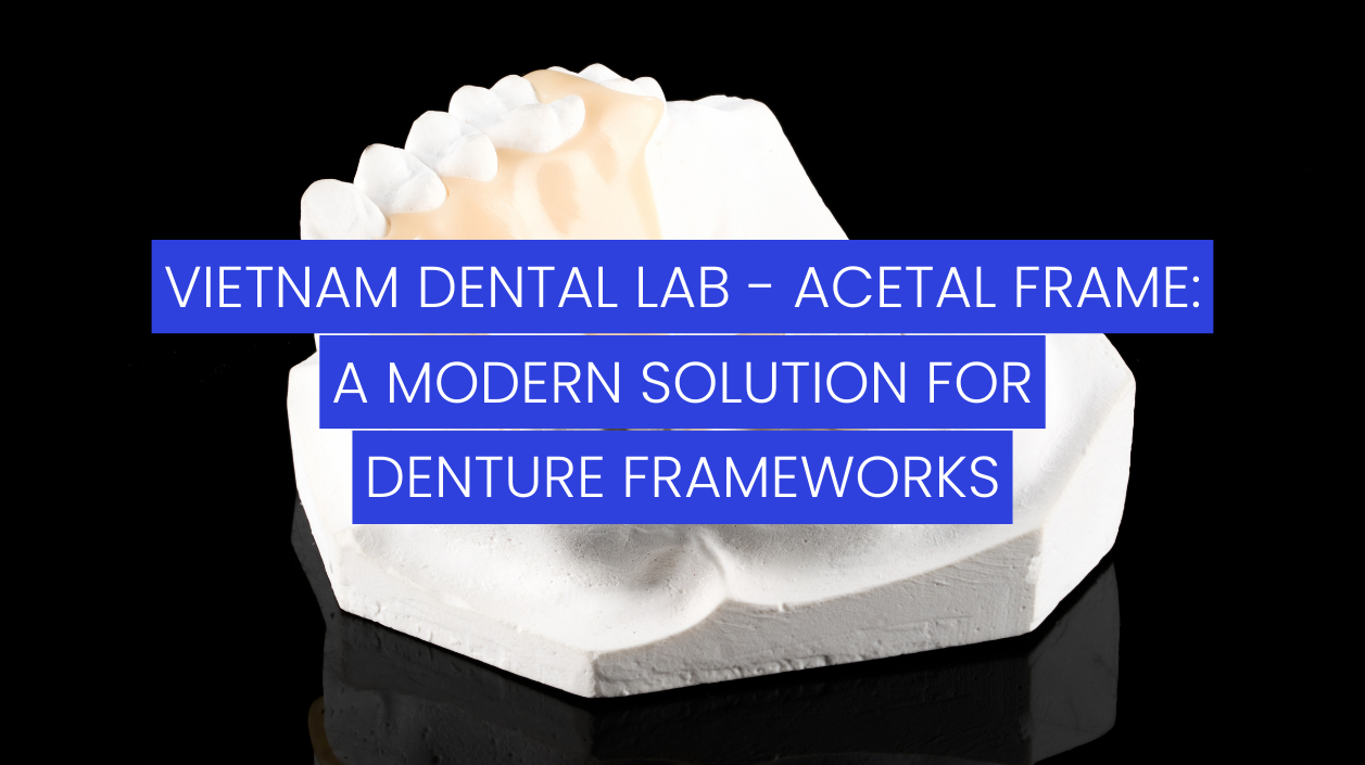 Acetal Frame: A Modern Solution for Denture Frameworks