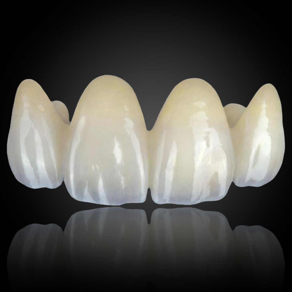 All-Ceramic Crown & Bridge - XDENT LAB
