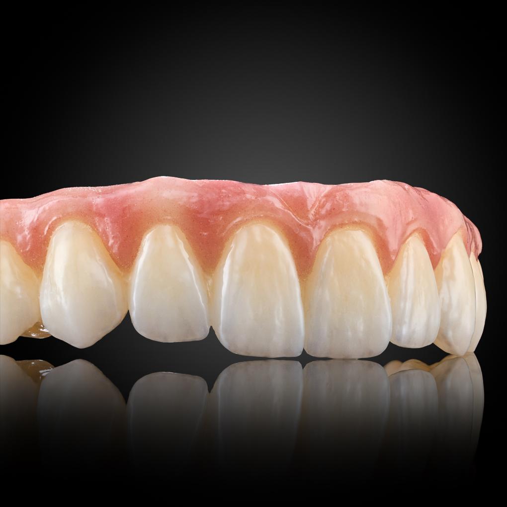 Full Arch Hybrid Bar - XDENT LAB