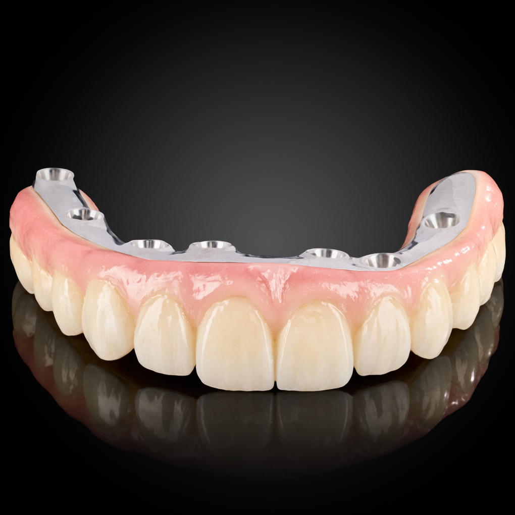 Full Arch Implant - XDENT LAB